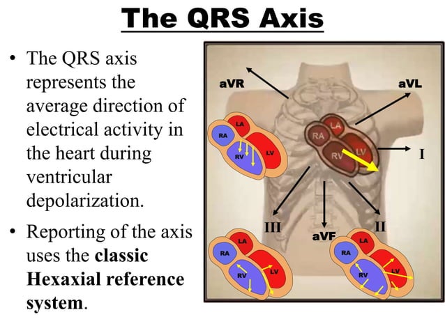 4. ecg basics rate and axis | PPT