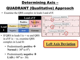 4. ecg basics rate and axis | PPTX | Heart and Cardiovascular Diseases ...