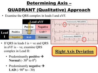 4. ecg basics rate and axis | PPTX | Heart and Cardiovascular Diseases ...