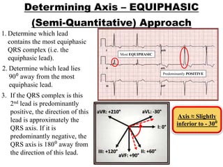 4. ecg basics rate and axis | PPTX | Heart and Cardiovascular Diseases ...