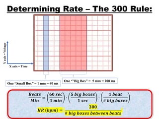 4. ecg basics rate and axis | PPTX | Heart and Cardiovascular Diseases ...