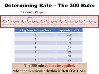 4. ecg basics rate and axis | PPTX | Heart and Cardiovascular Diseases ...