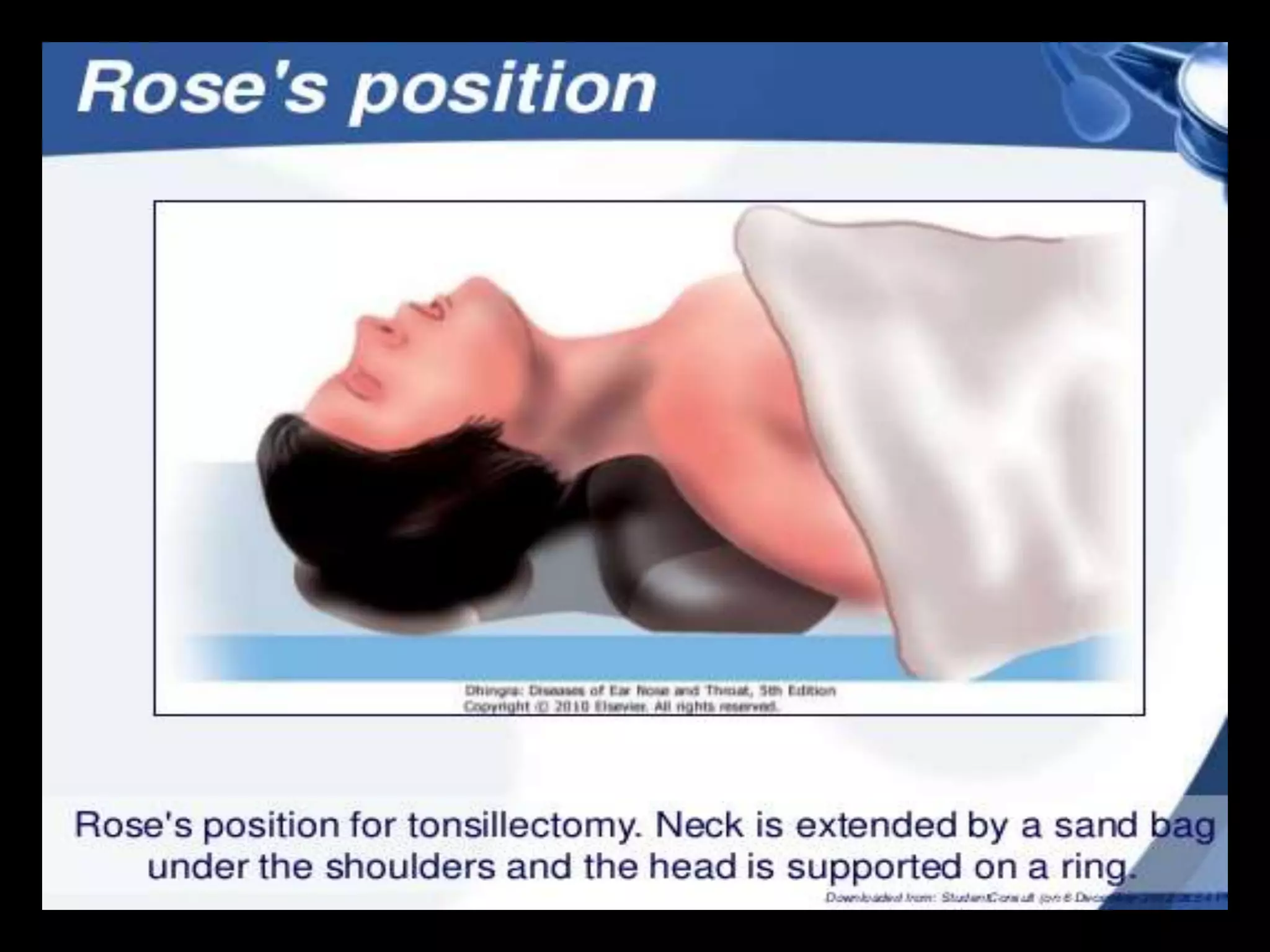 4.tonsillectomy, adenoidectomy and quinsy | PPT