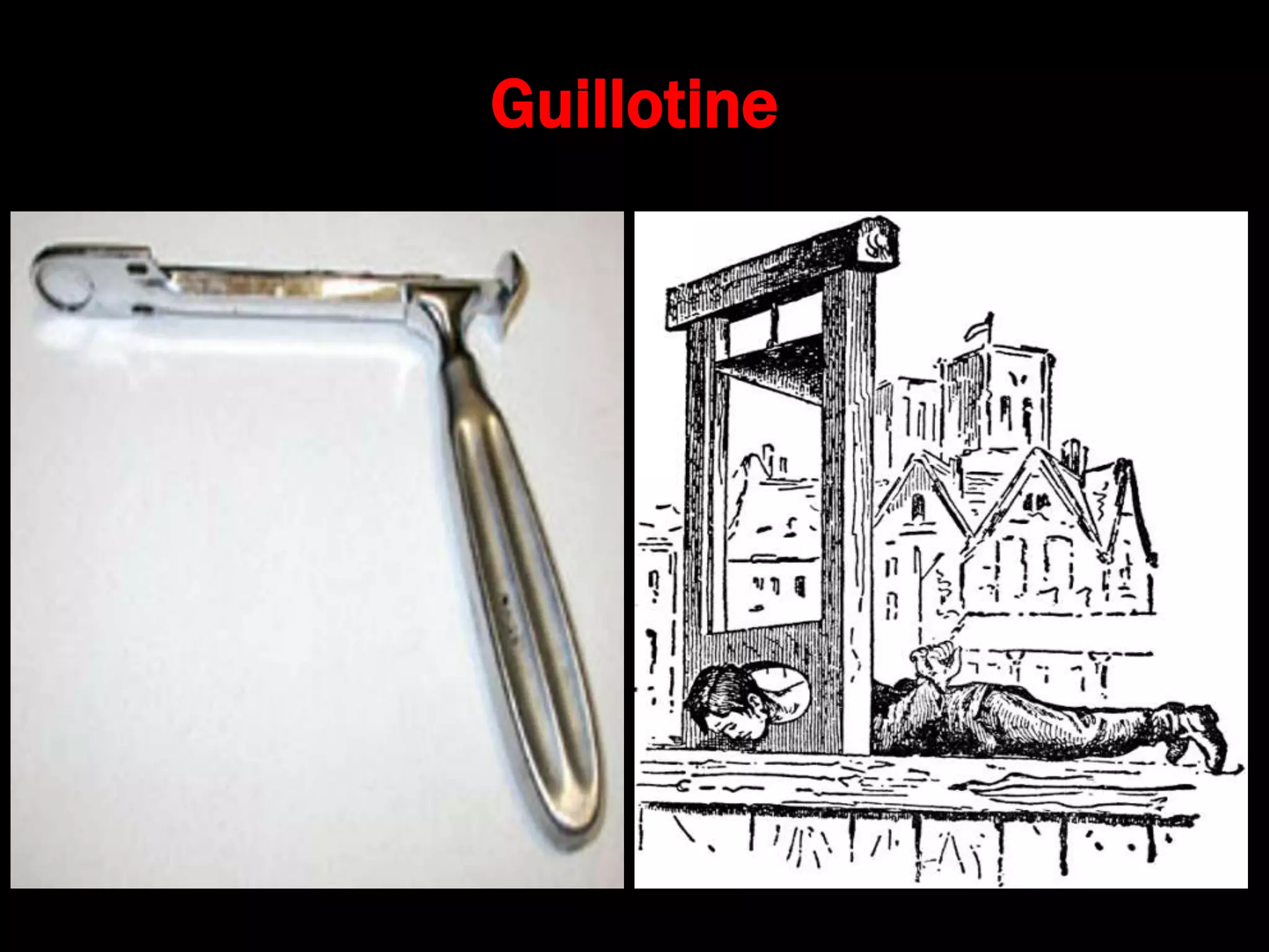 4.tonsillectomy, adenoidectomy and quinsy | PPT