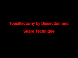 4.tonsillectomy, adenoidectomy and quinsy | PPT