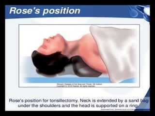 4.tonsillectomy, adenoidectomy and quinsy | PPT