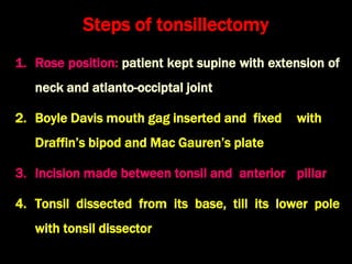 4.tonsillectomy, adenoidectomy and quinsy | PPT