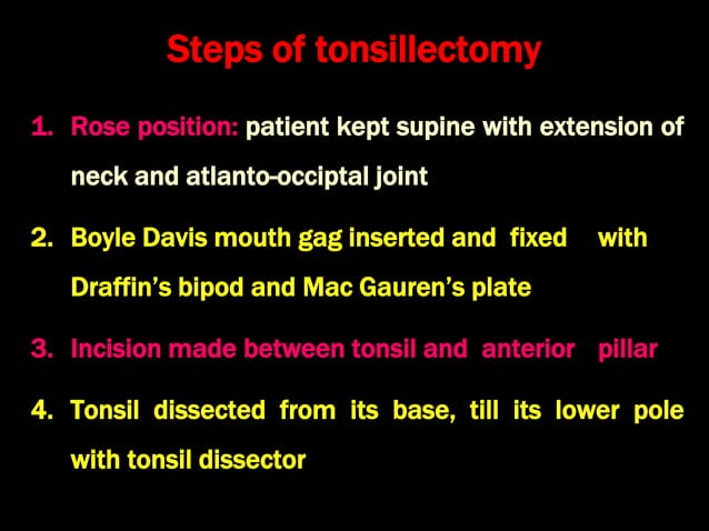 4.tonsillectomy, adenoidectomy and quinsy | PPT