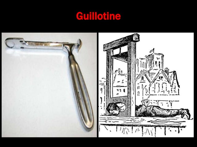 4.tonsillectomy, adenoidectomy and quinsy | PPT