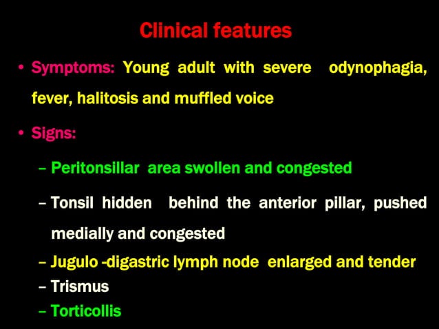 4.tonsillectomy, adenoidectomy and quinsy | PPT