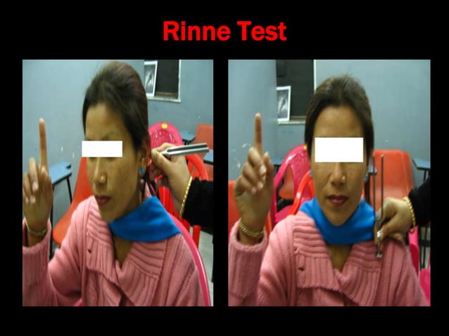 4. Routine clinical tests of hearing | PPT