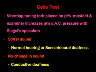 4. Routine clinical tests of hearing | PPT