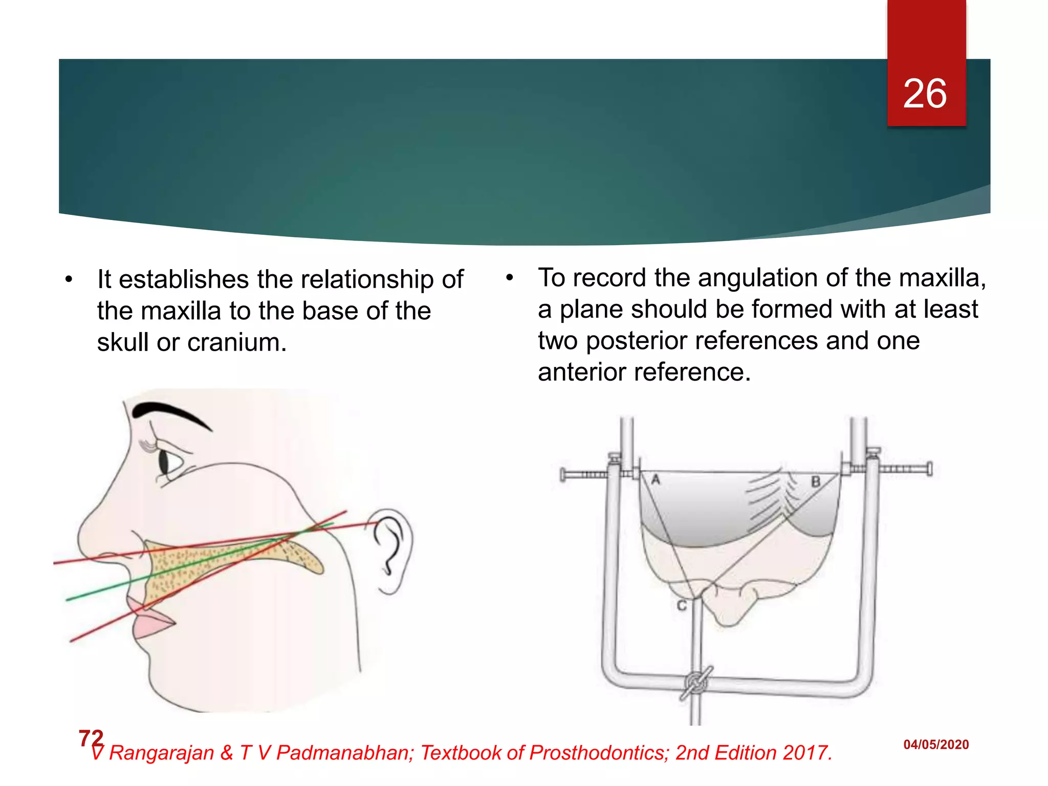 orientation jaw relation in complete denture fabrication | PPTX