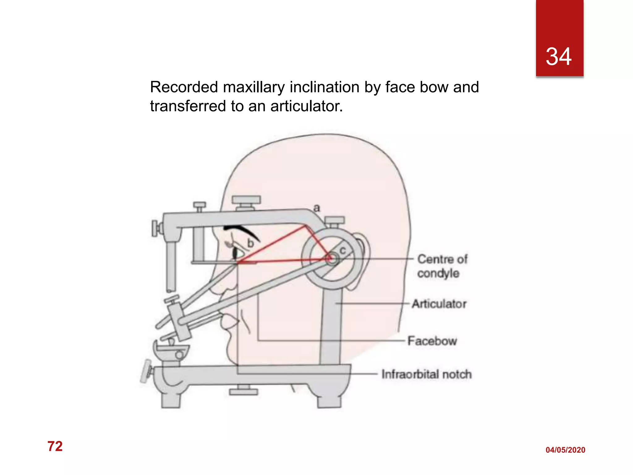 orientation jaw relation in complete denture fabrication | PPTX