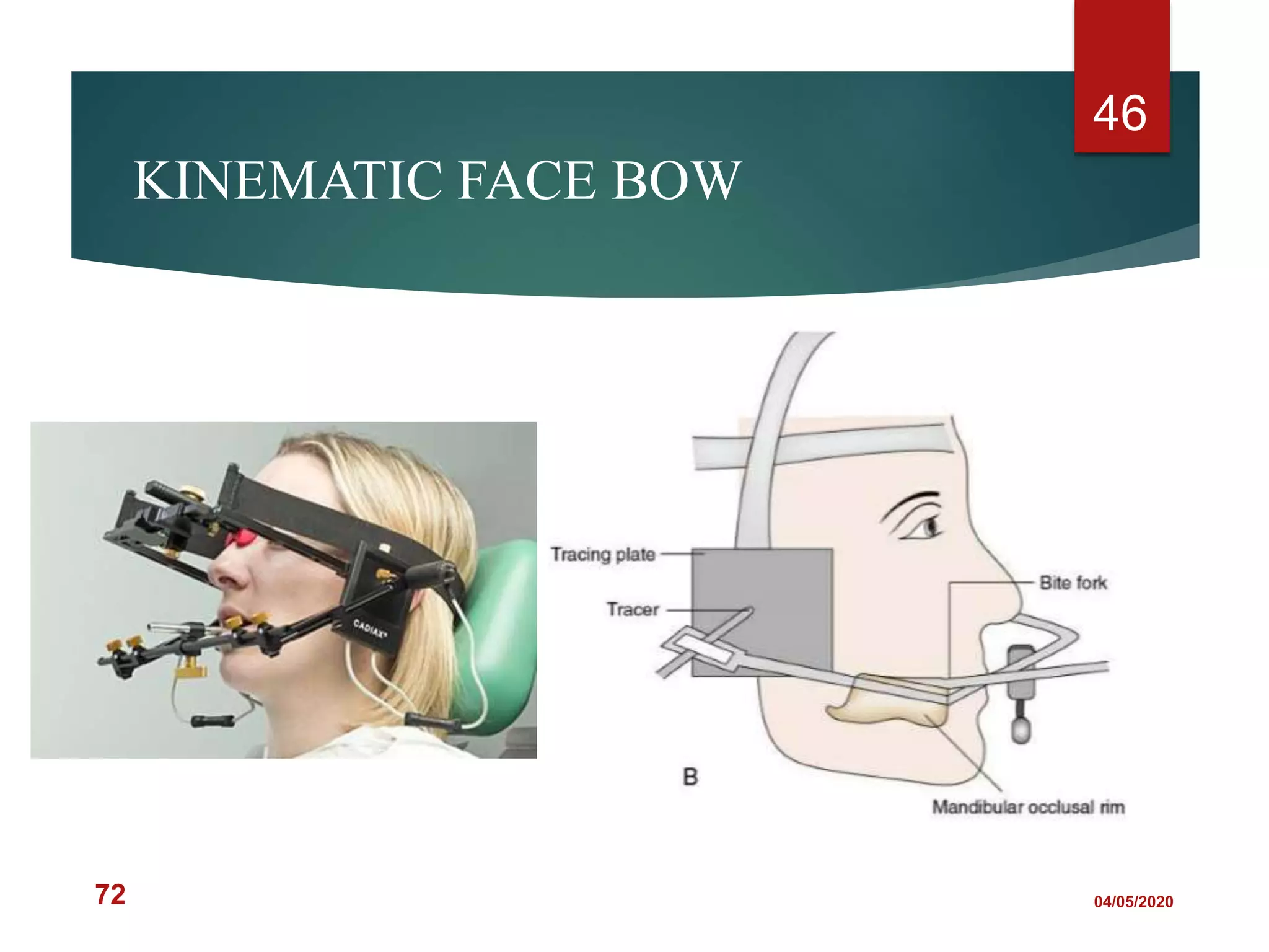 orientation jaw relation in complete denture fabrication | PPTX