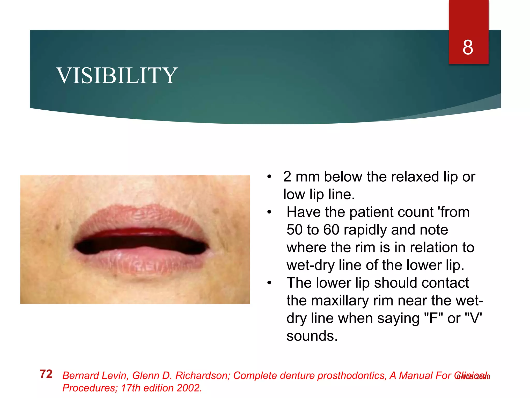 orientation jaw relation in complete denture fabrication | PPTX