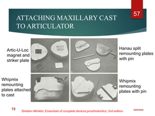 orientation jaw relation in complete denture fabrication | PPTX