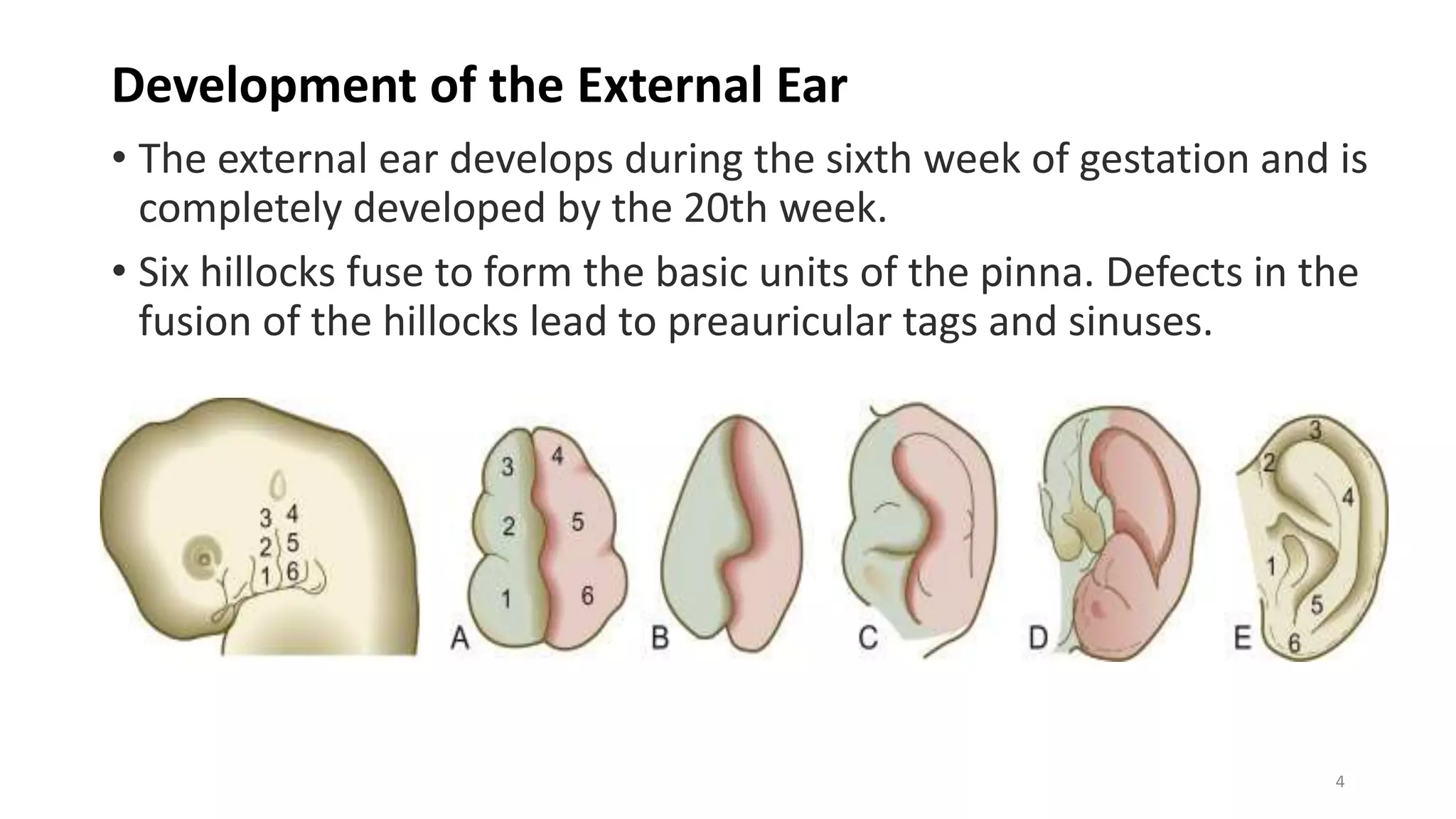 Ear development by Dr Shakil Sadiq | PPTX | Ear, Nose and Throat ...