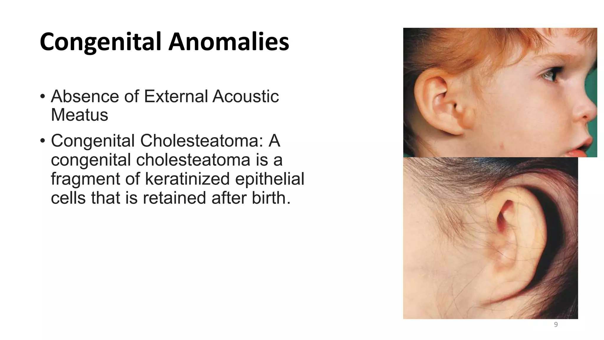Ear development by Dr Shakil Sadiq | PPTX | Ear, Nose and Throat ...