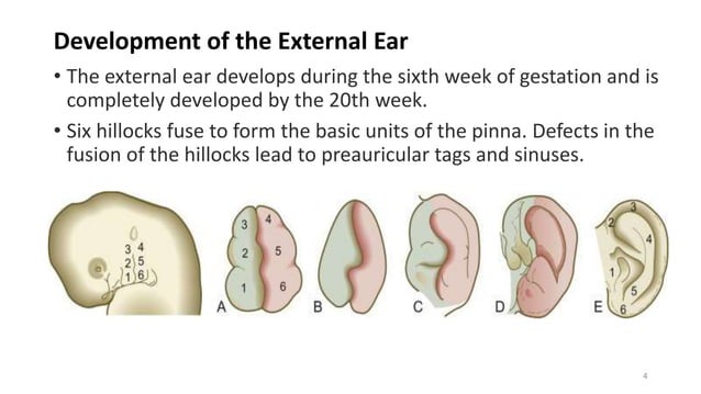 Ear development by Dr Shakil Sadiq | PPTX | Ear, Nose and Throat Conditions | Diseases and ...
