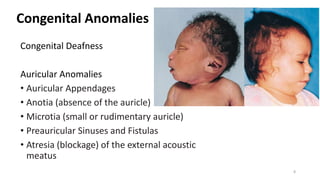 Ear development by Dr Shakil Sadiq | PPTX