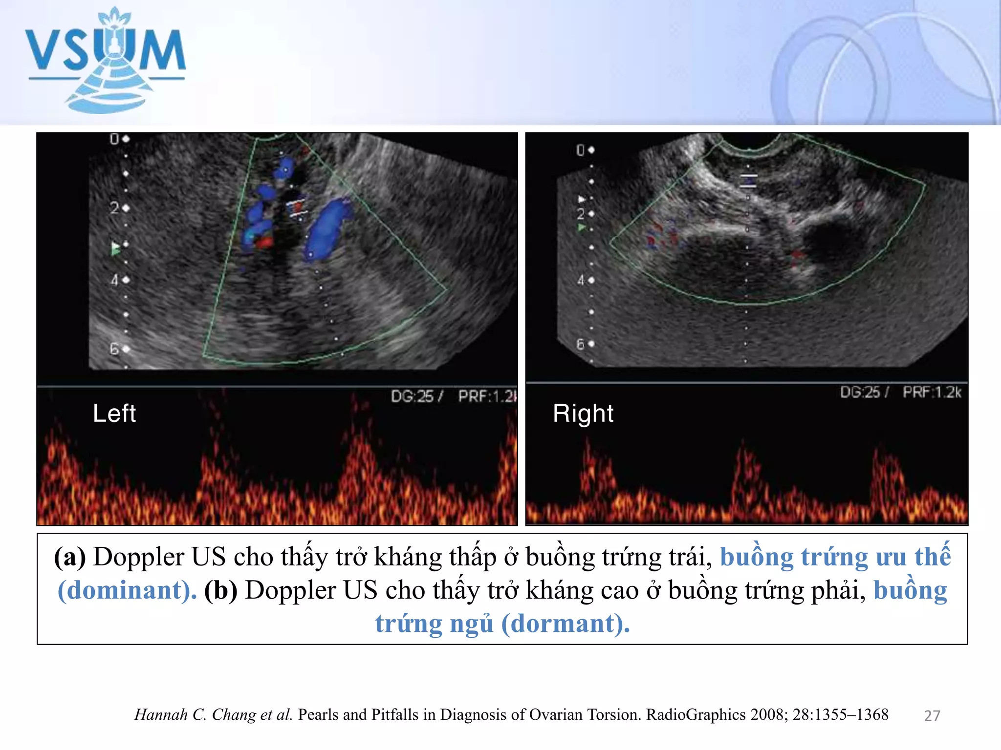 4. sacd xoan phan phu.10.2017.vsum.medic.k23