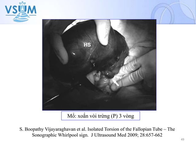 4. sacd xoan phan phu.10.2017.vsum.medic.k23