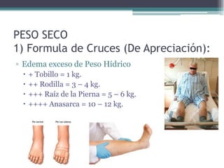 Nutrición y enfermedades hepáticas | PDF