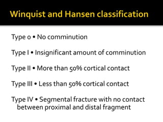 Fracture shaft of femur | PPTX