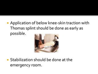 Fracture shaft of femur | PPTX