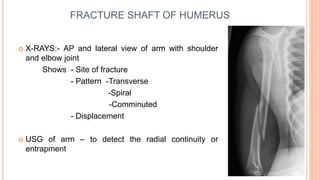 Shaft of humerus fracture | PPTX
