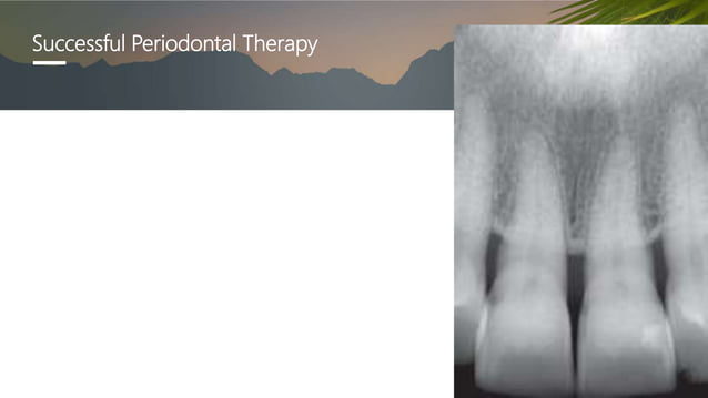 Radiographic Interpretation of Periodontal Diseases | PPTX | Dental ...