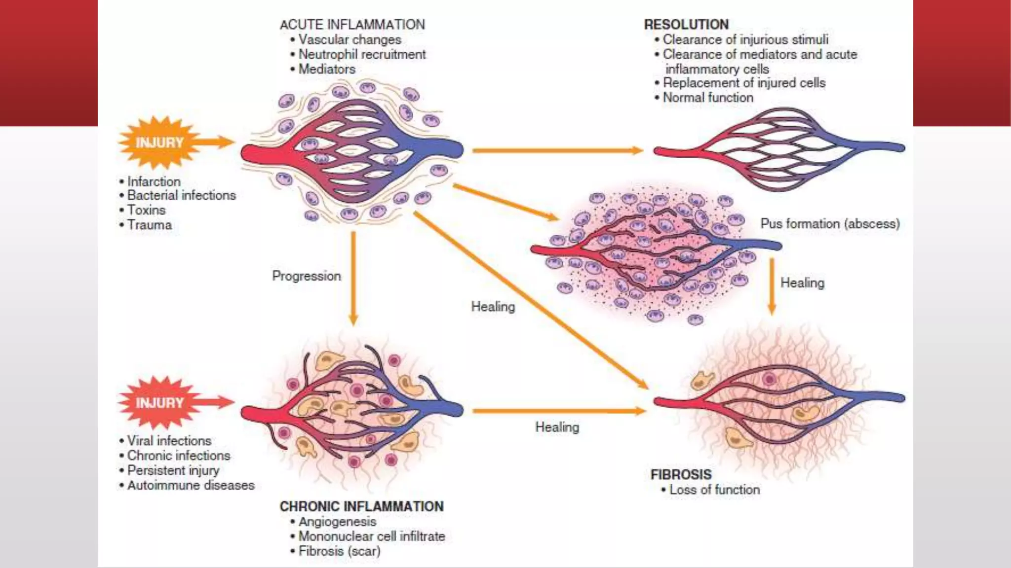 Basic Features of Inflammation and Repair | PPT