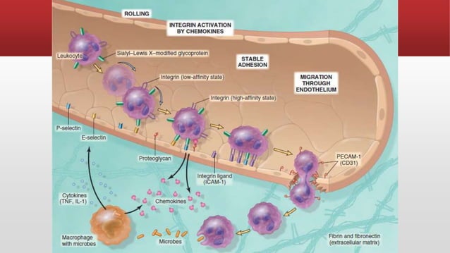 Basic Features of Inflammation and Repair | PPT