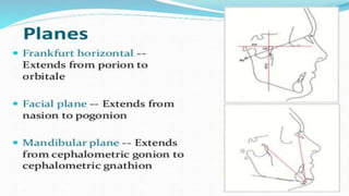 Mastication, orientatory lines and dental xray | PPT
