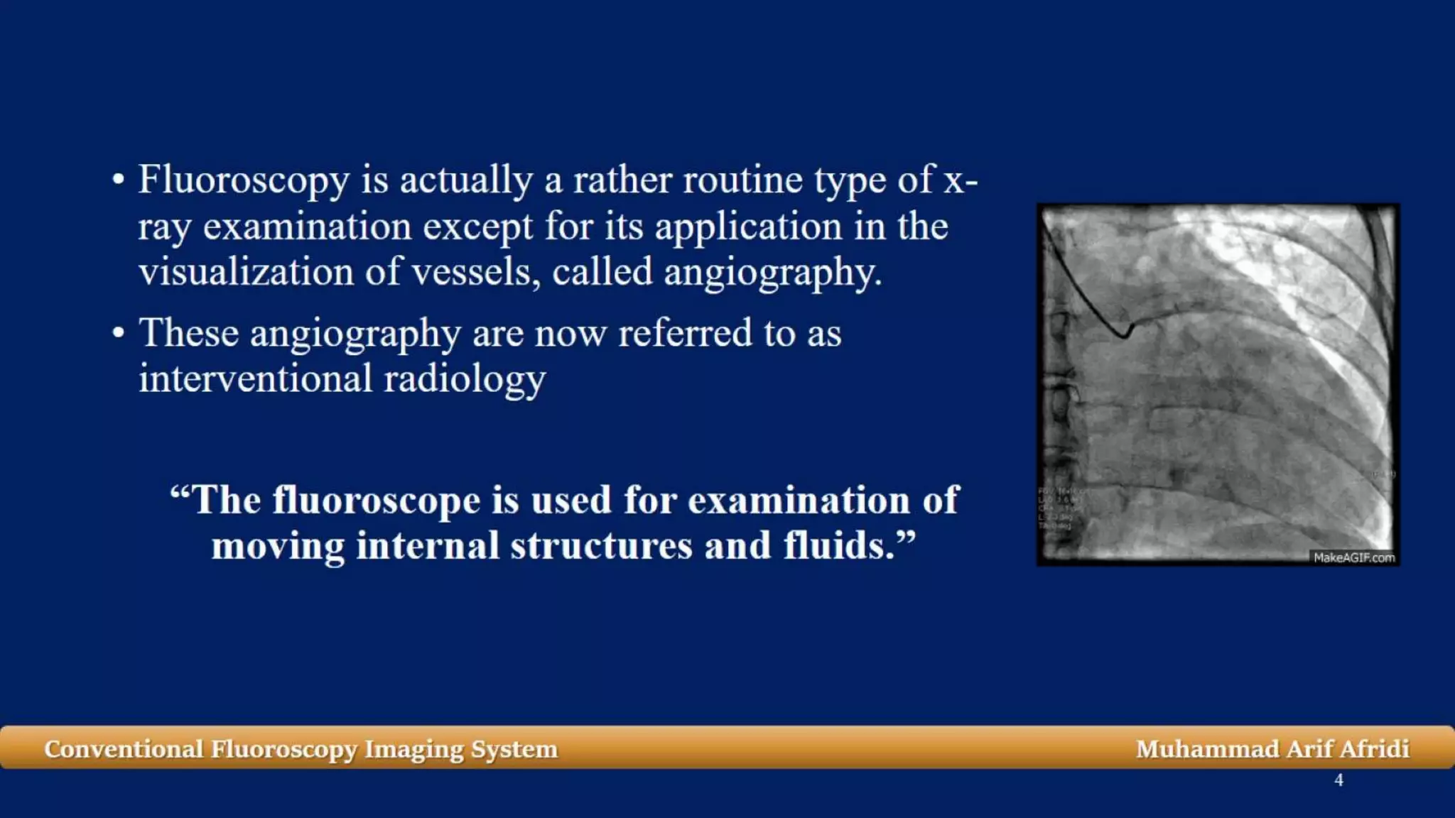 Conventional Fluoroscopy 2020 updated | PPTX