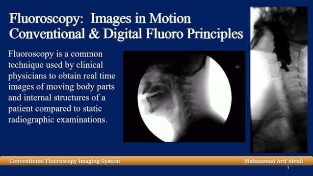 Conventional Fluoroscopy 2020 updated | PPTX