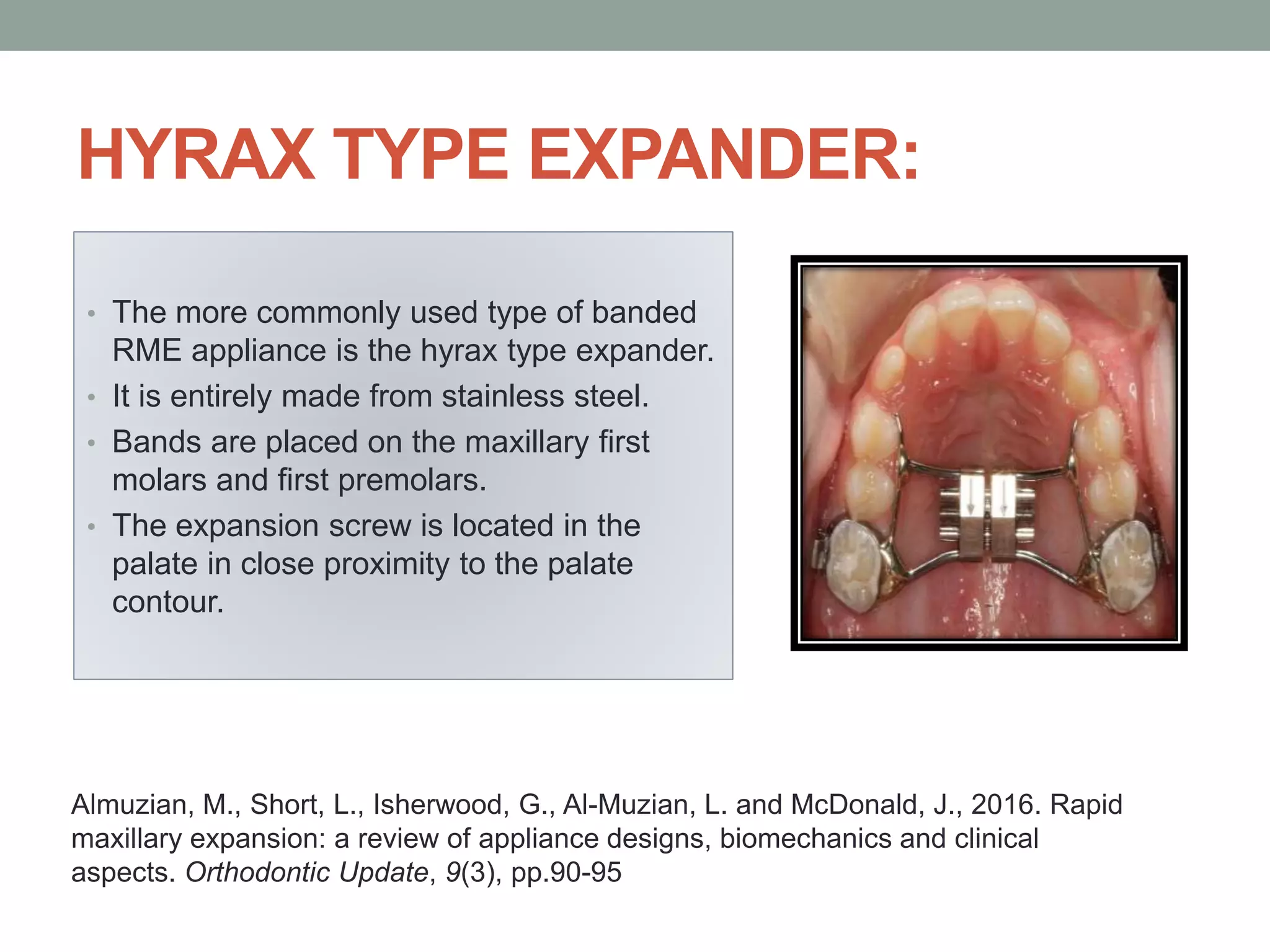 RAPID MAXILLARY EXPANSION VS SLOW MAXILLARY EXPANSION | PPTX