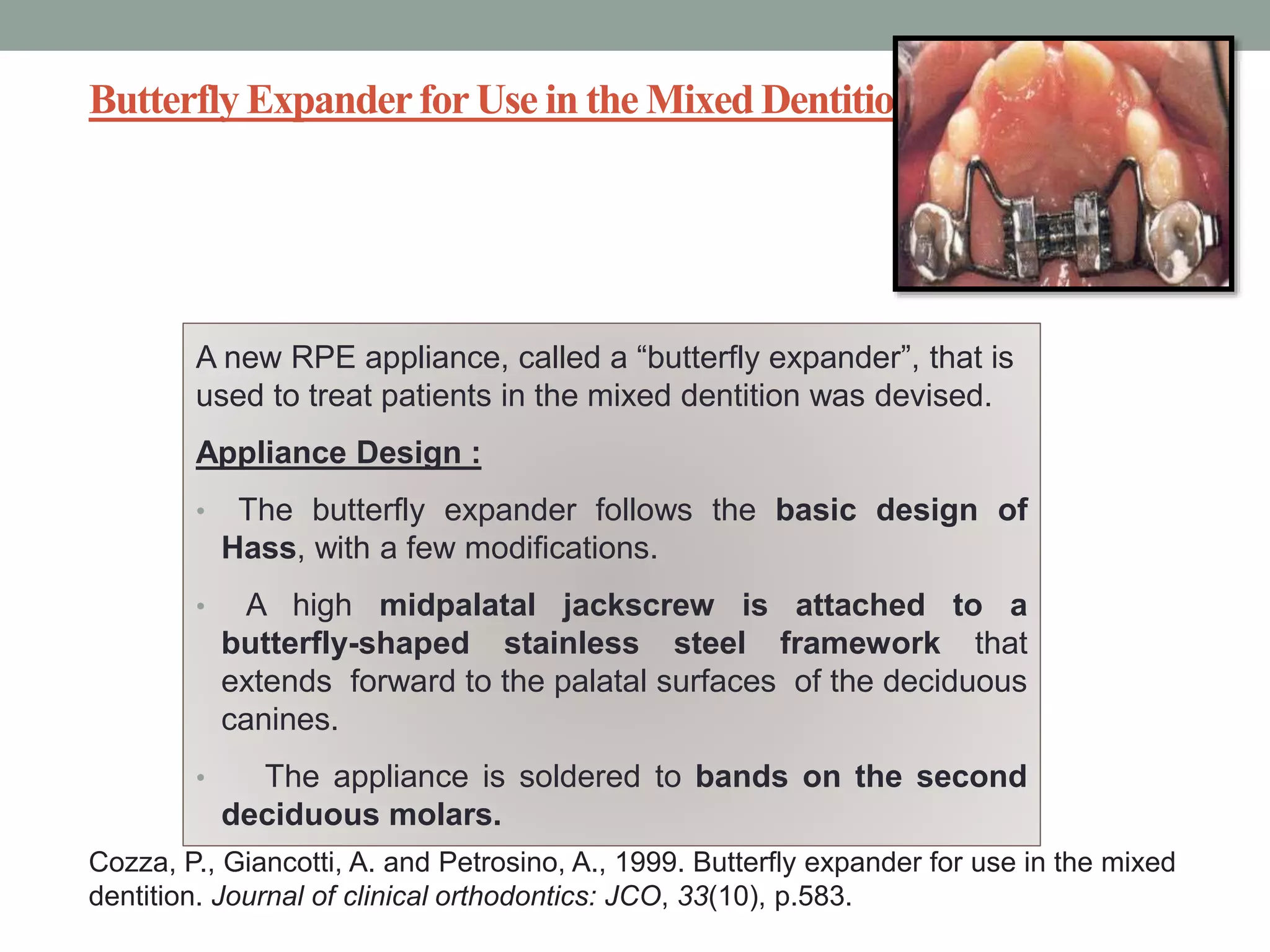 RAPID MAXILLARY EXPANSION VS SLOW MAXILLARY EXPANSION | PPTX