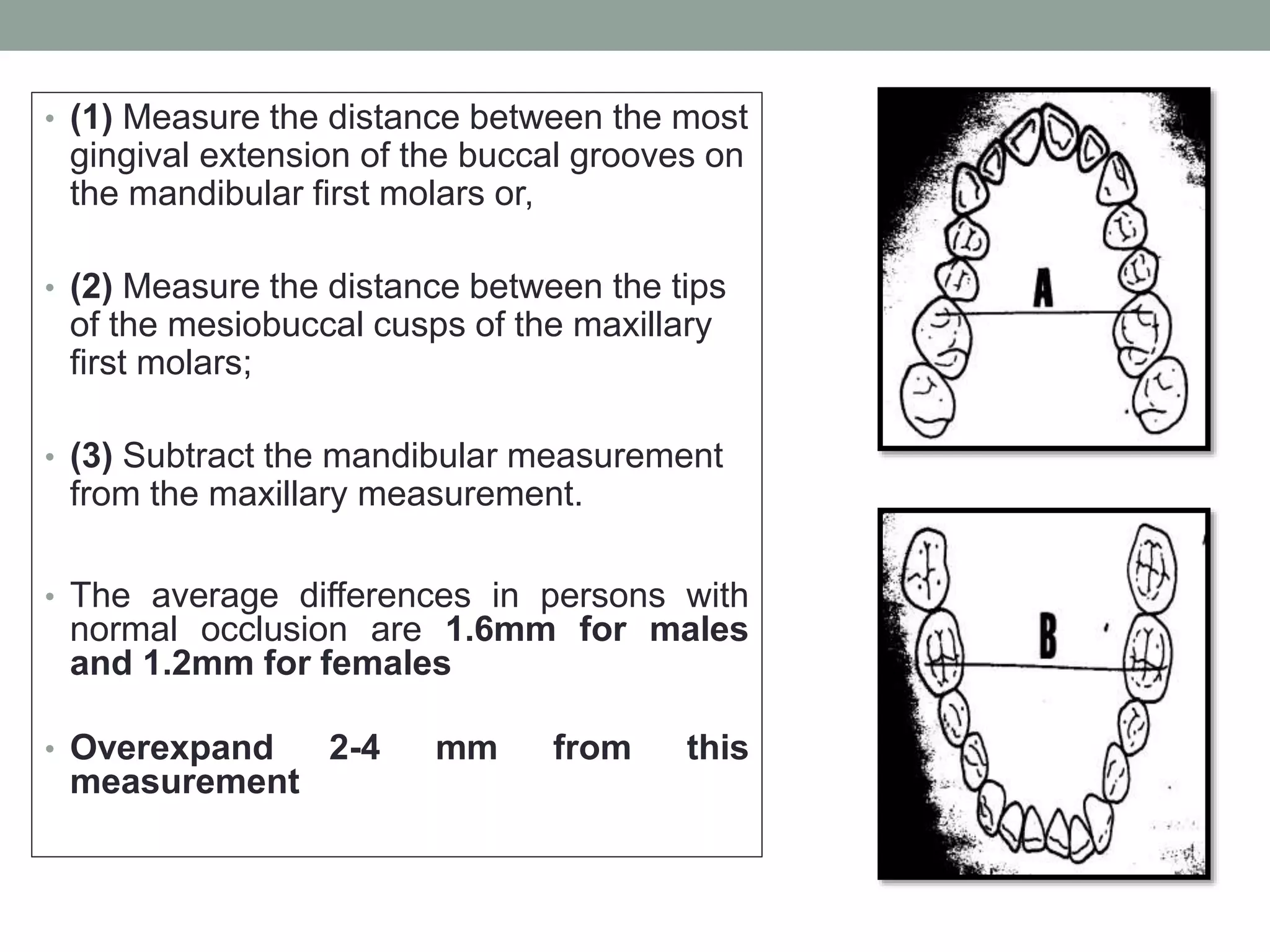 RAPID MAXILLARY EXPANSION VS SLOW MAXILLARY EXPANSION | PPTX
