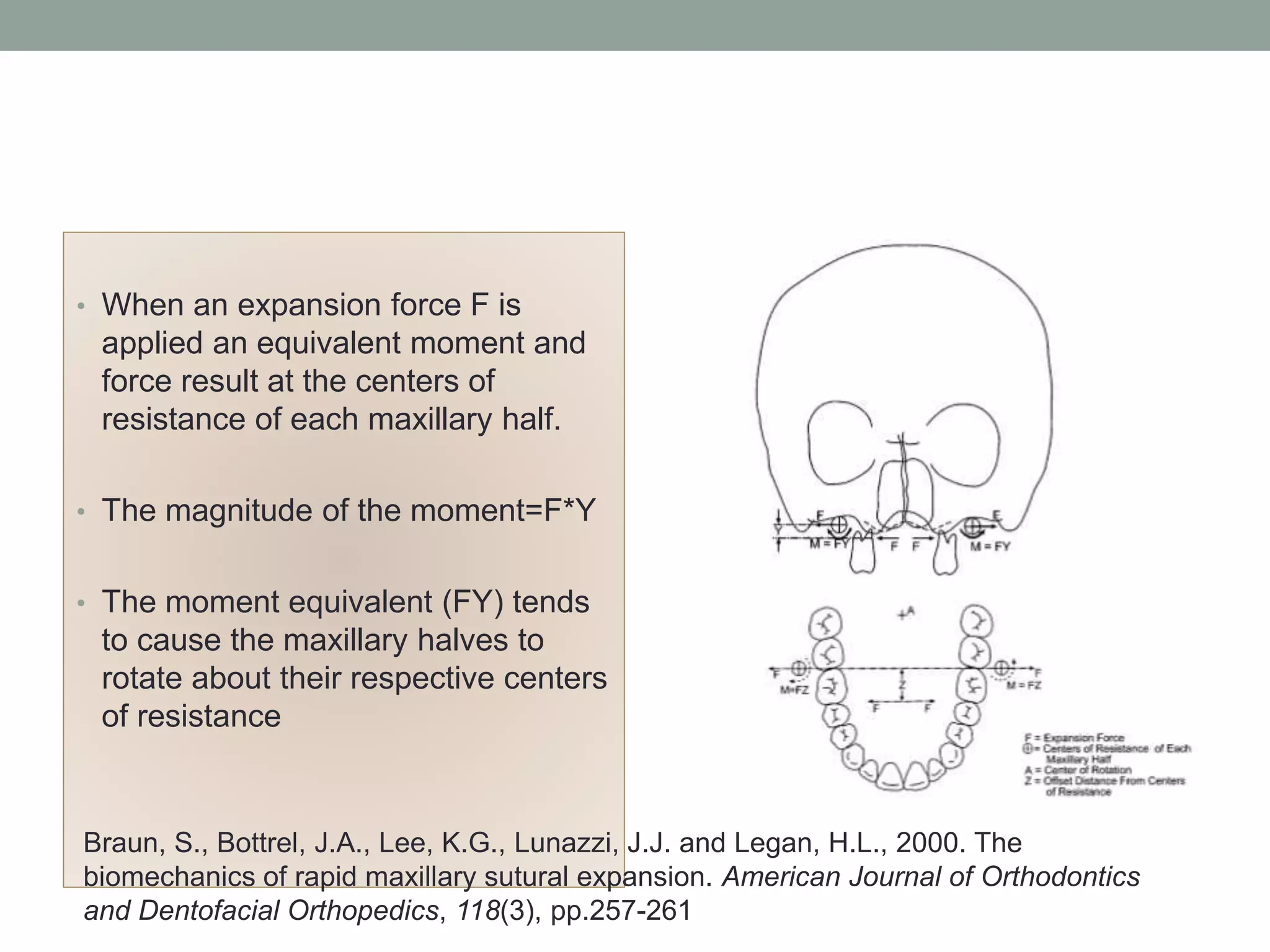 RAPID MAXILLARY EXPANSION VS SLOW MAXILLARY EXPANSION | PPTX