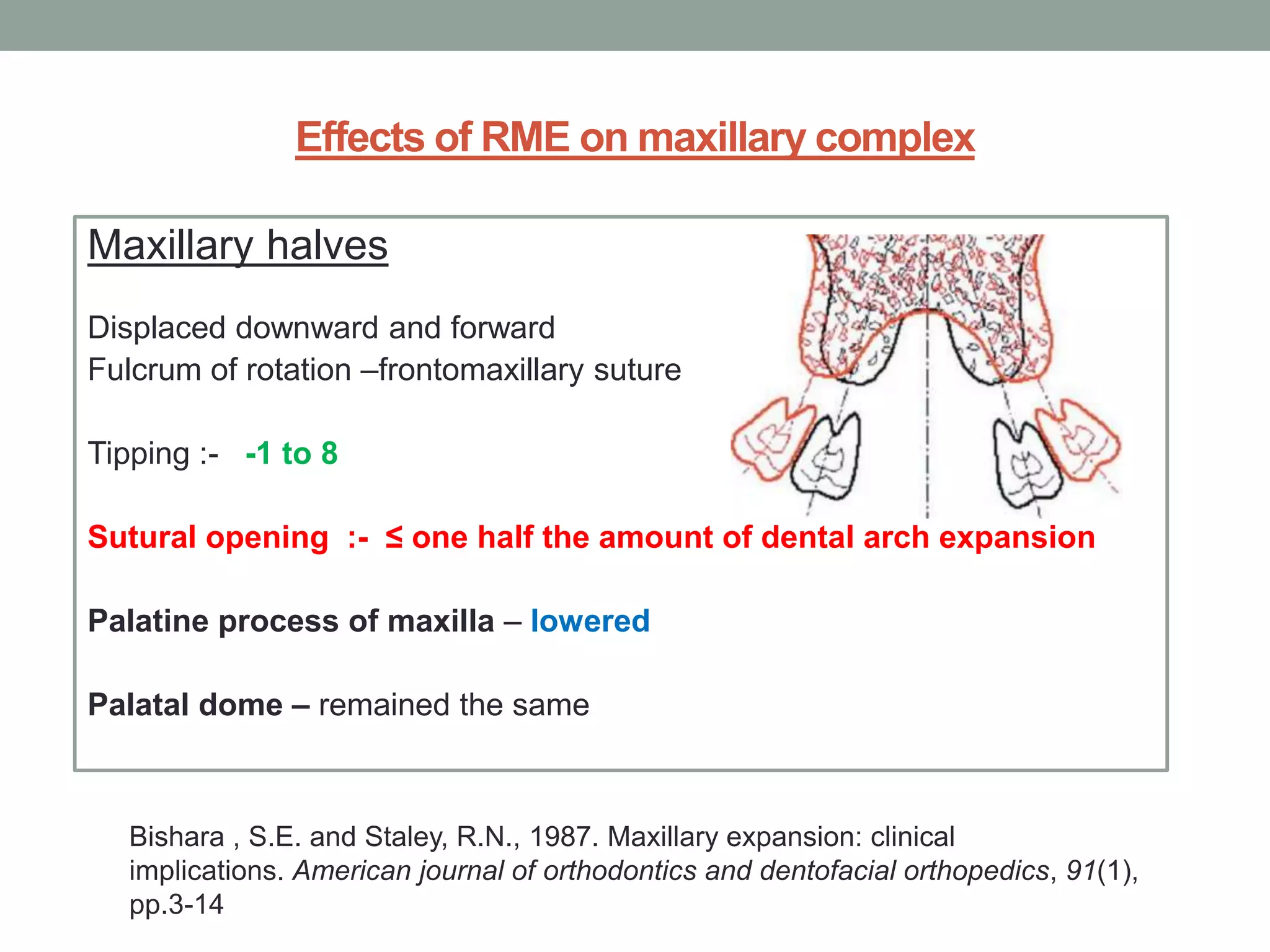 RAPID MAXILLARY EXPANSION VS SLOW MAXILLARY EXPANSION | PPTX