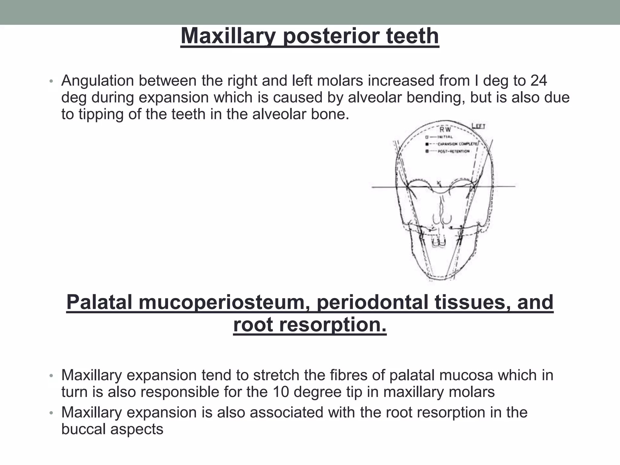RAPID MAXILLARY EXPANSION VS SLOW MAXILLARY EXPANSION | PPTX