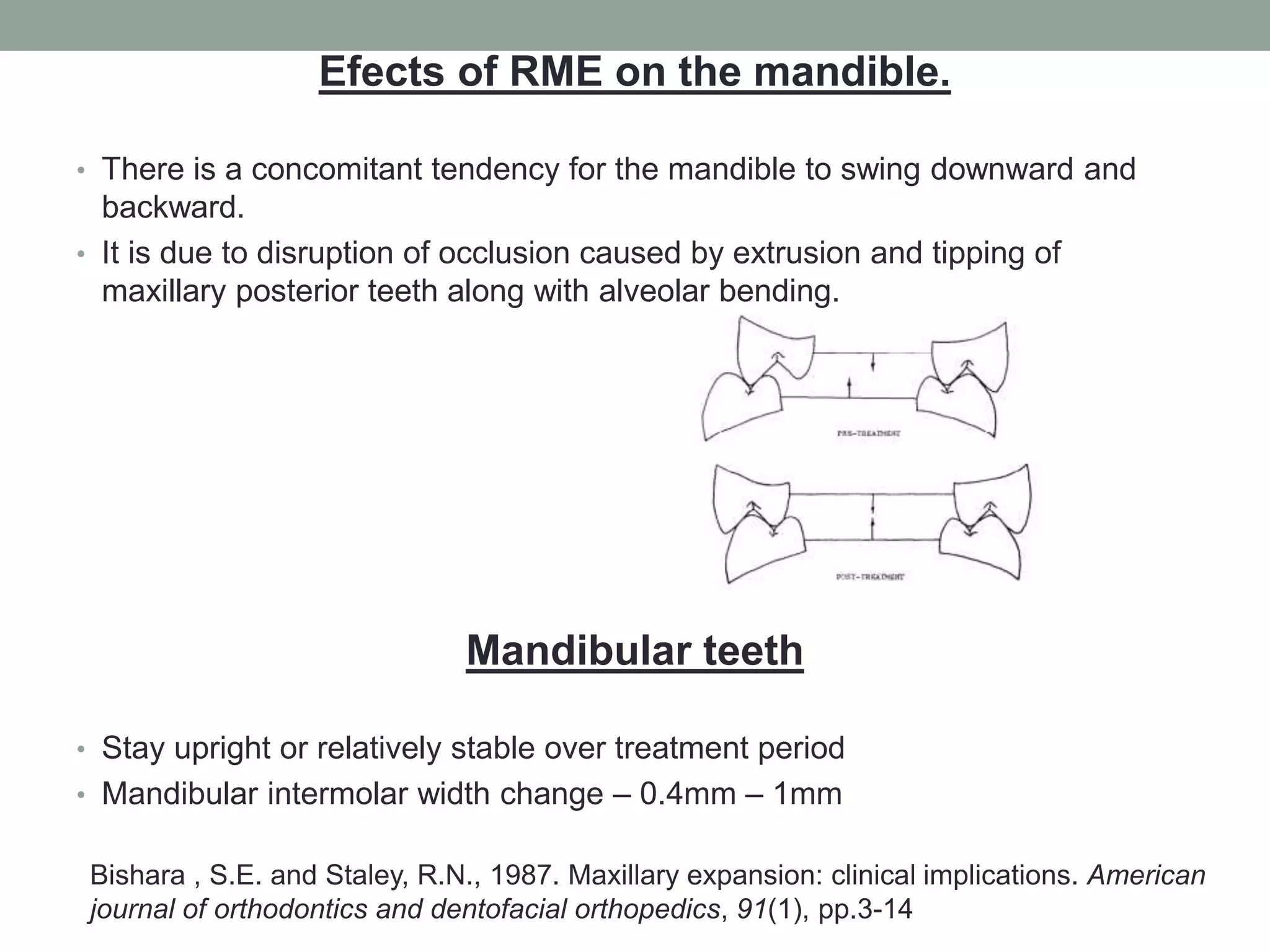 RAPID MAXILLARY EXPANSION VS SLOW MAXILLARY EXPANSION | PPTX