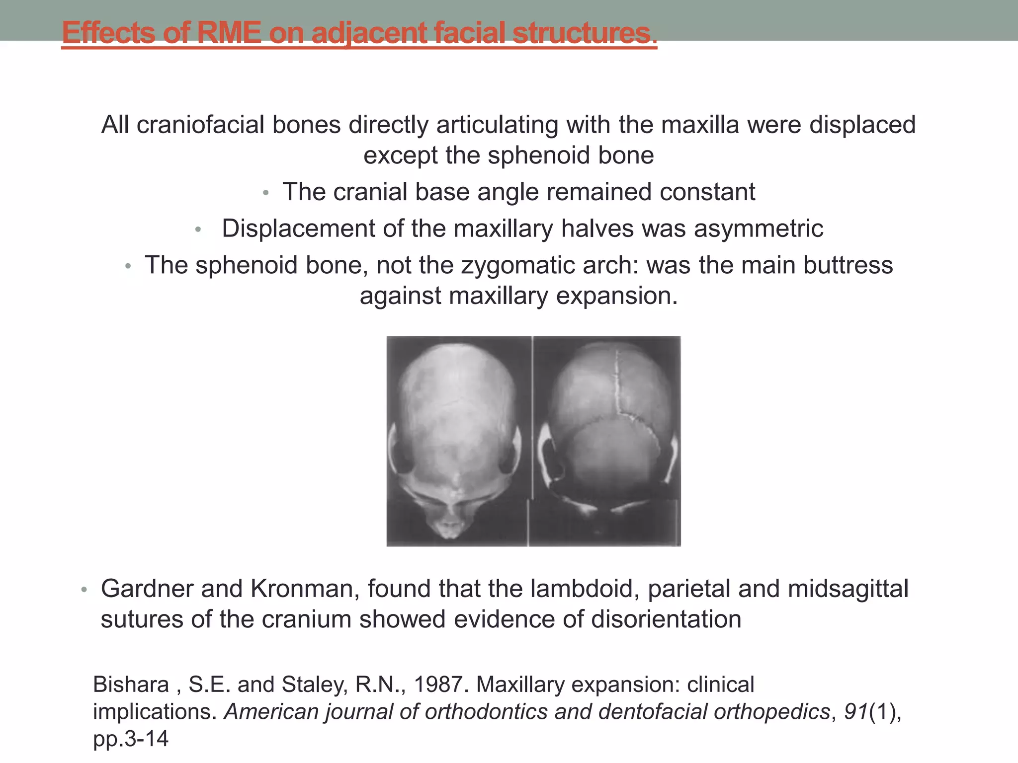 RAPID MAXILLARY EXPANSION VS SLOW MAXILLARY EXPANSION | PPTX