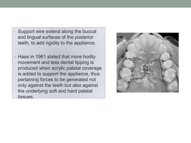 RAPID MAXILLARY EXPANSION VS SLOW MAXILLARY EXPANSION | PPTX