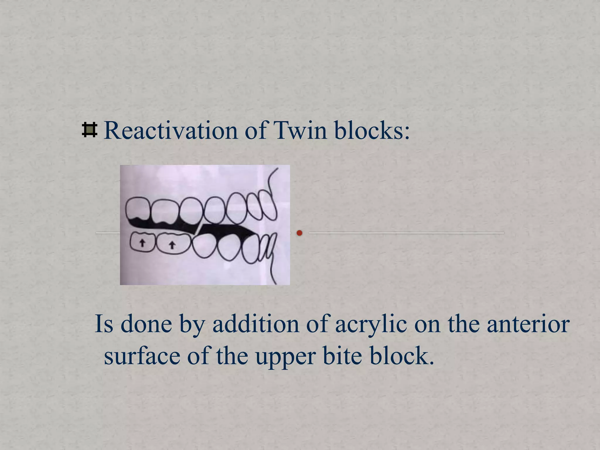 twin block | PPTX