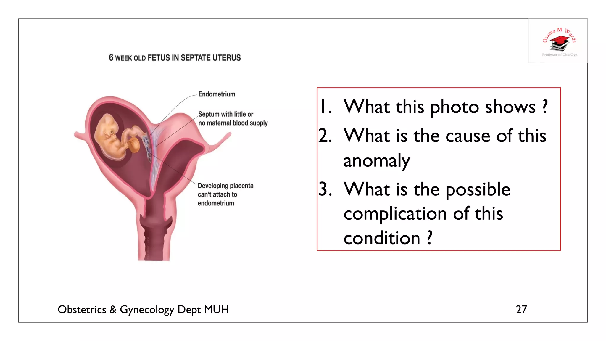4.OBSTETRICS&GYNECOLOGY REVISION-4 | PDF