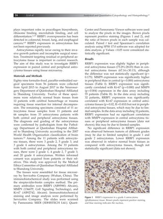 RRBP1 Expression in Paired Central and Peripheral Astrocytoma Tissue ...