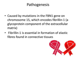 4.marfansyndrome | PPTX
